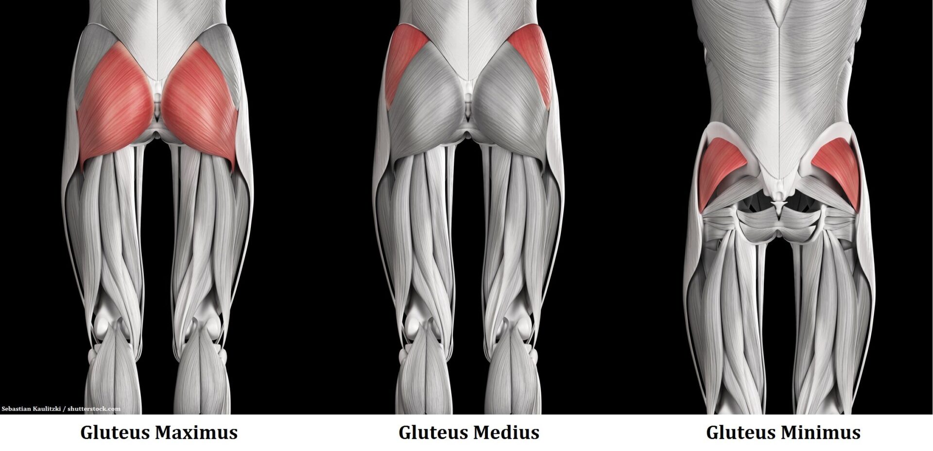 Hip Dips: Why Do I Have Them, and Can I Minimize Them? - Iru Veli